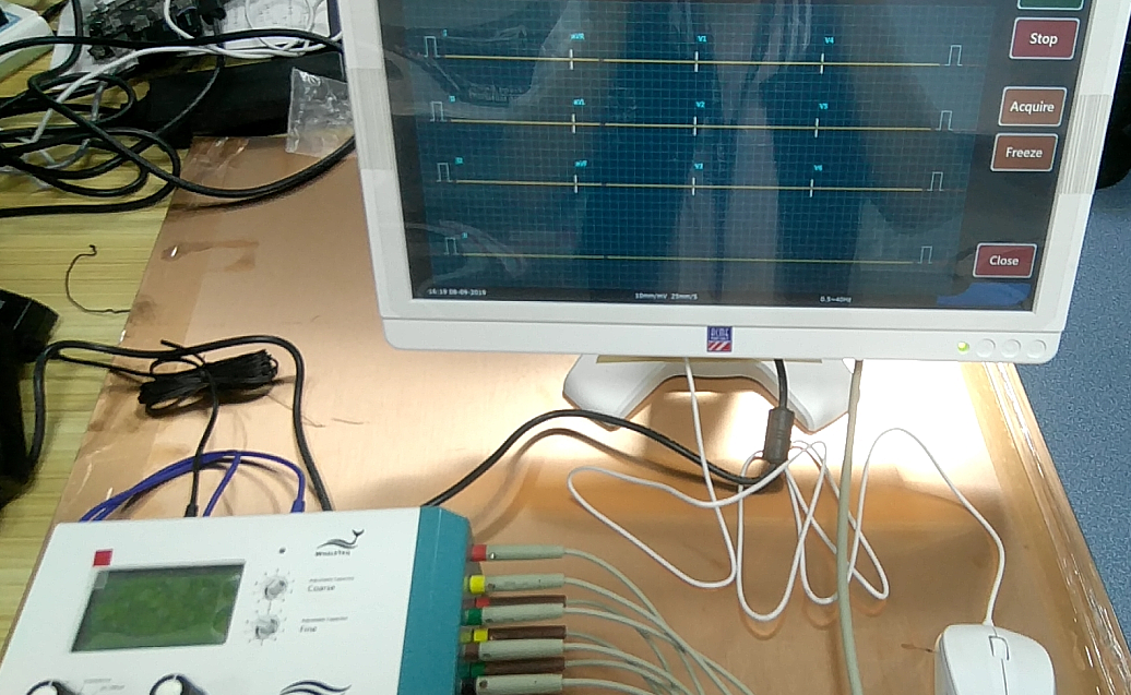 Figure 6a – ECG Device Sample Tested by CMRR – 百佳泰 Allion Labs