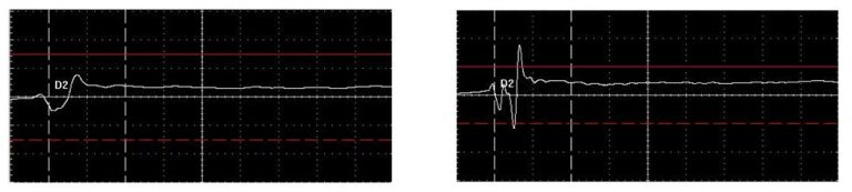 High Speed HDMI Cable規格比一比：測試攻略總整理 | 百佳泰 Allion Labs